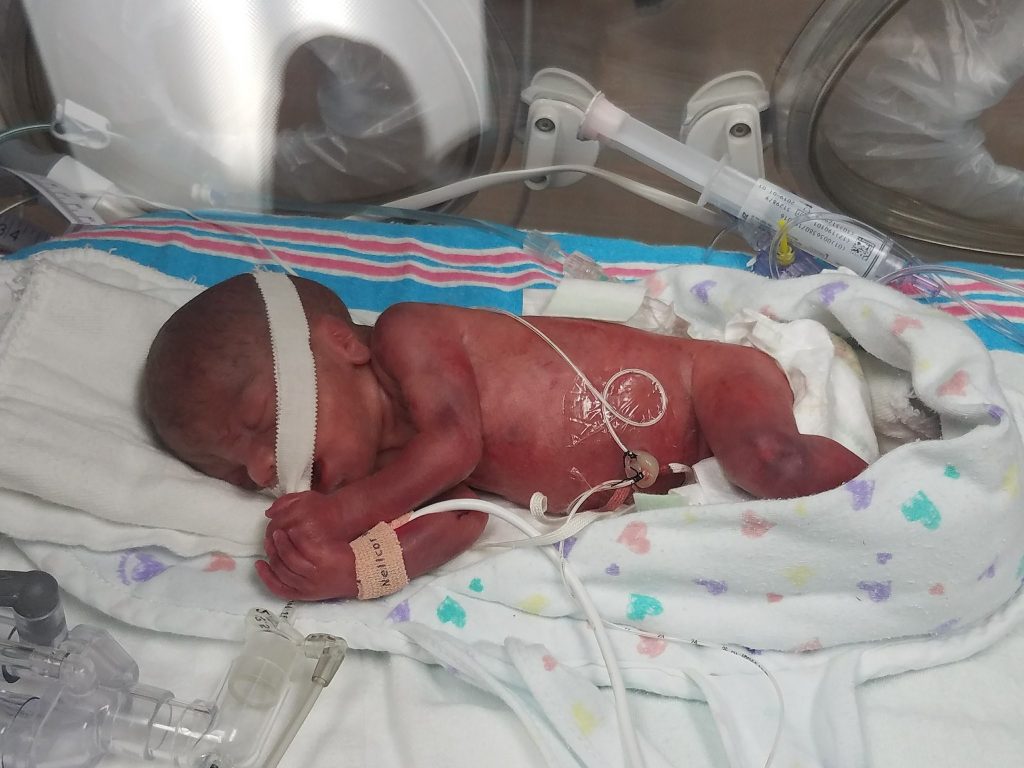 At Camp, Gavin Thrives in His Own Skin - Rainbows United